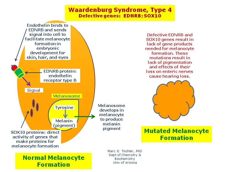 Waardenburg Syndrome Type 4 Hereditary Ocular Diseases